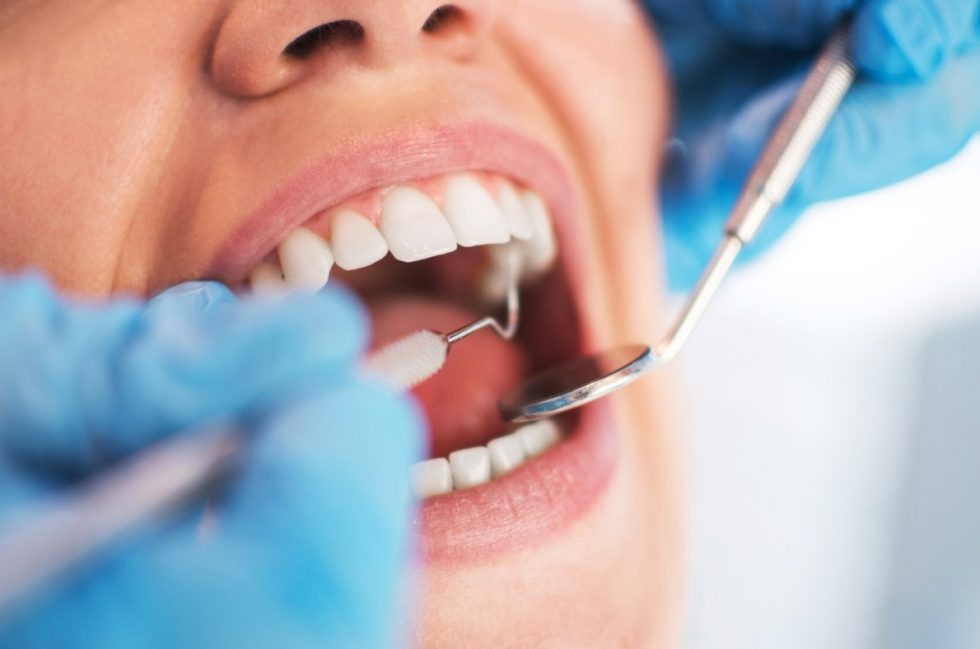 Parodontologija | Dental Škaričić